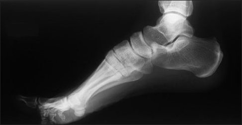 RENTGENOVÉ ZÁŘENÍ