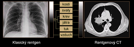 RENTGENOVÉ ZÁŘENÍ