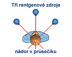 RENTGENOVÉ ZÁŘENÍ